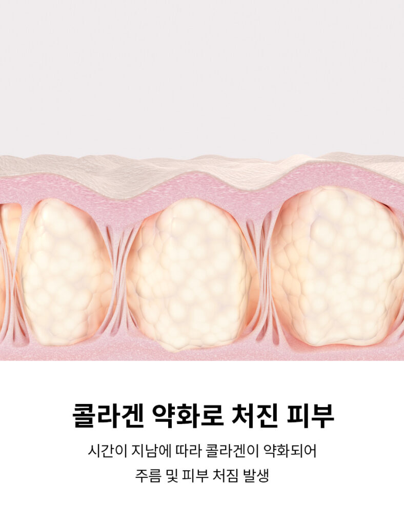 울쎄라 - MILI CLINIC