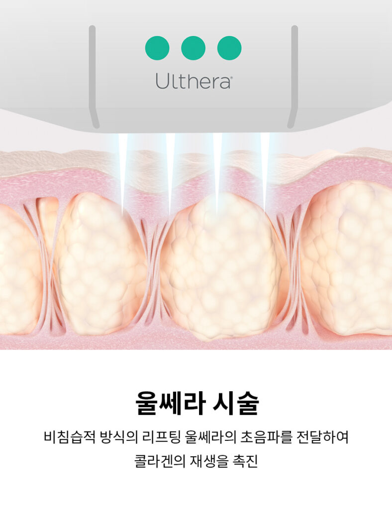 울쎄라 - MILI CLINIC